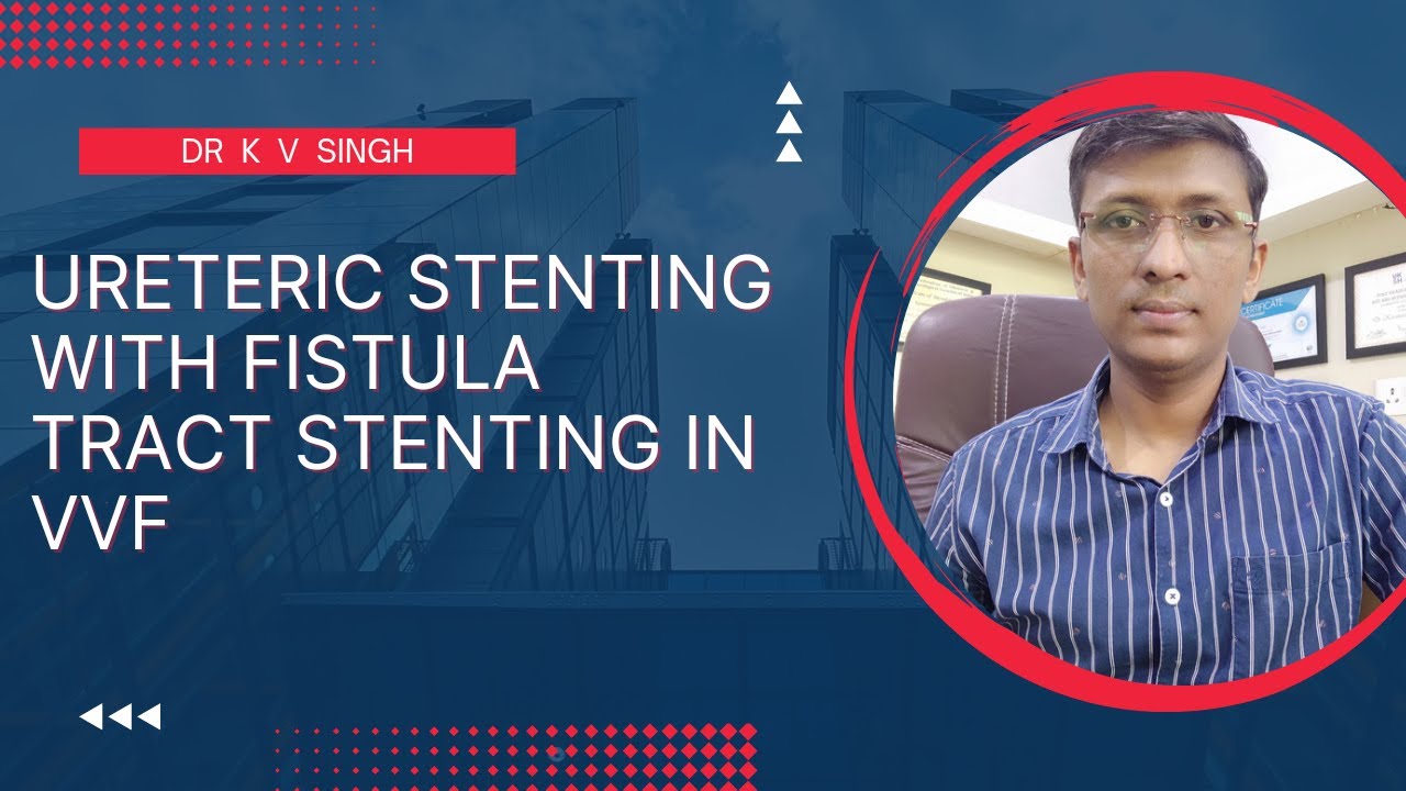 ureteric stenting with vvf fistula tract stenting done with tubal ...