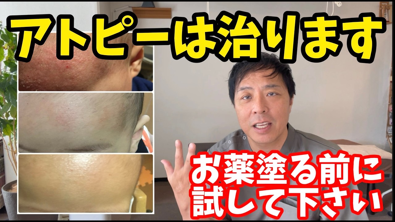 【アトピー の治し方 】アトピー性皮膚炎 を自分でケアする方法 Youtube