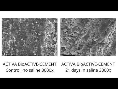 SEM Analysis of ACTIVA BioACTIVE-CEMENT after 21 Days in Saline - YouTube