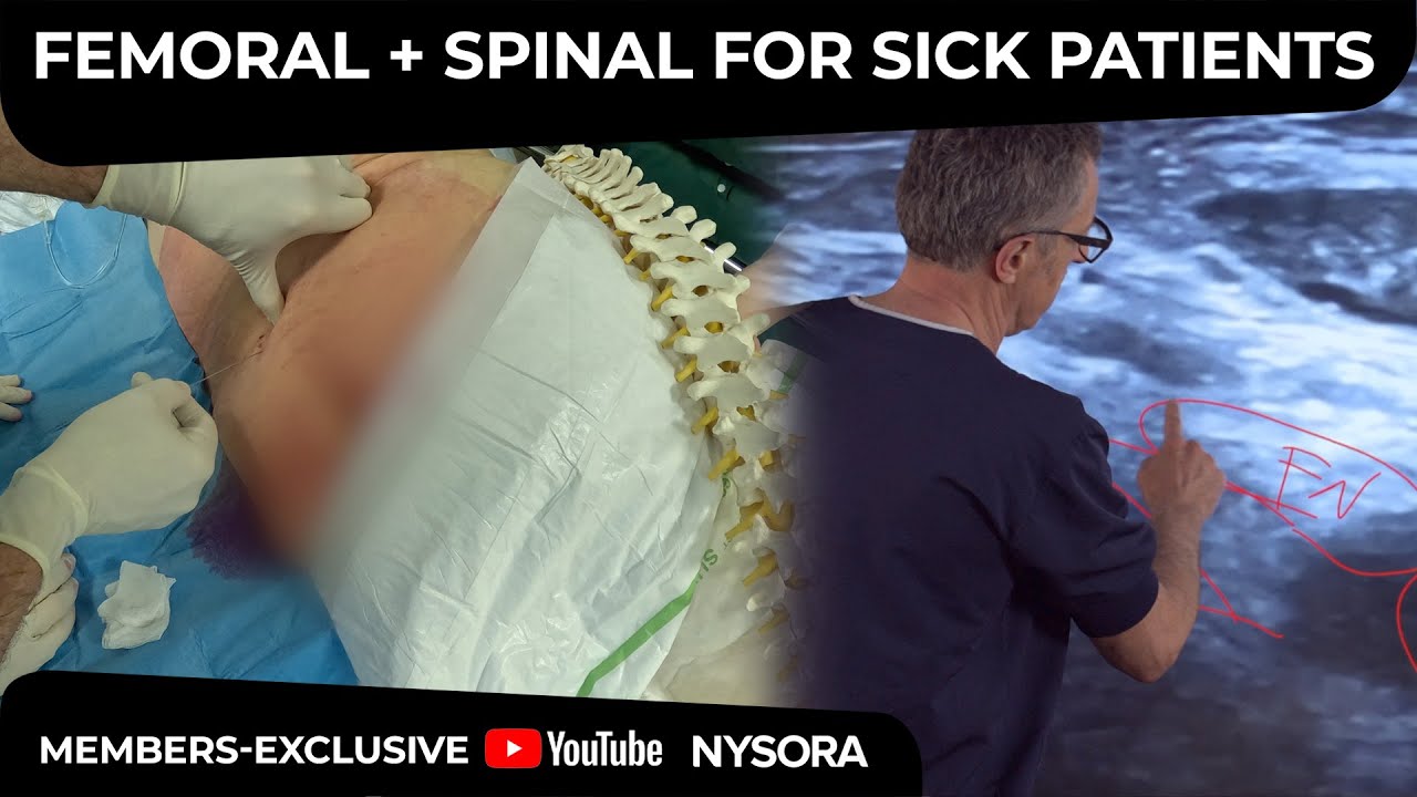 FEMORAL + SPINAL COMBO FOR SICK PATIENTS - YouTube