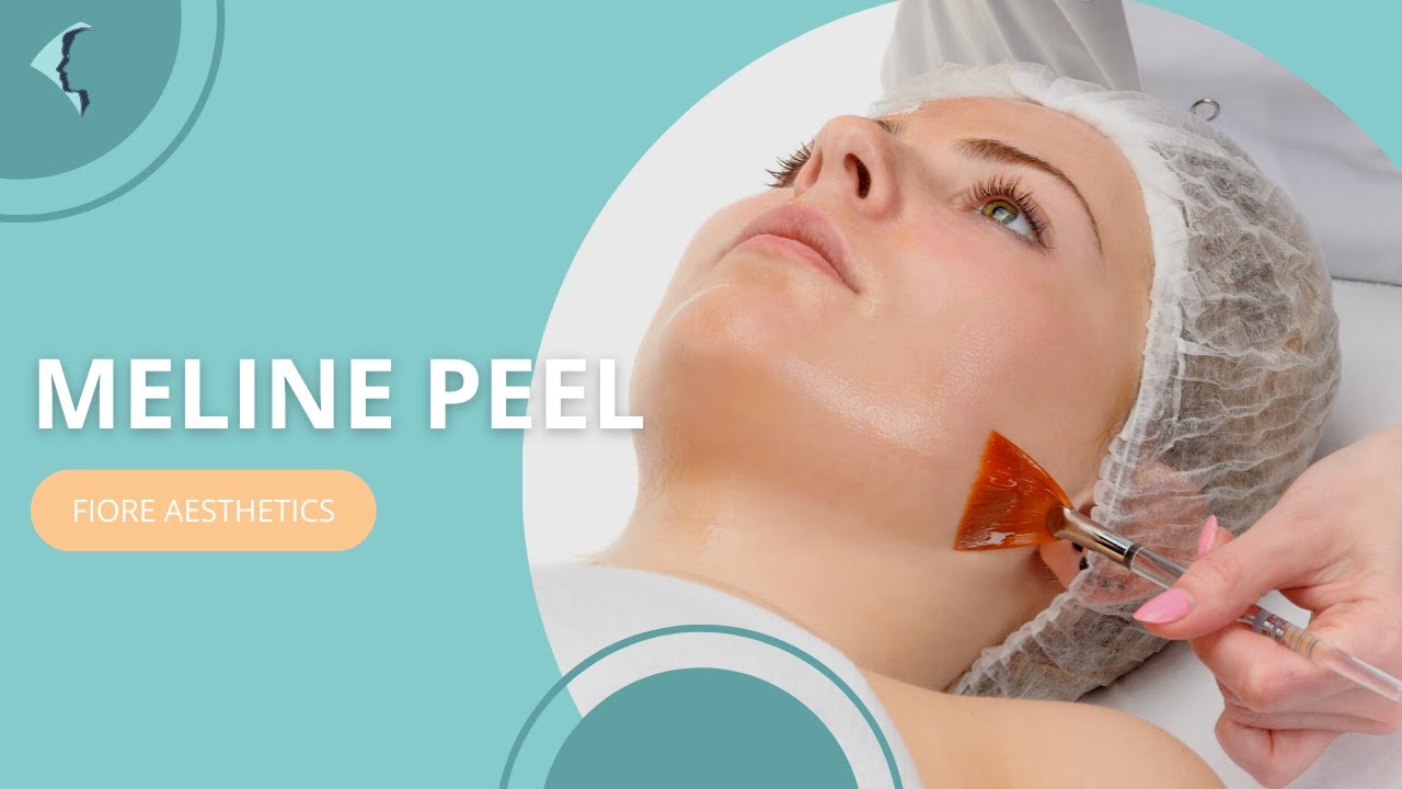 Clinica Fiore Skin Clinic London MELINE Peel - YouTube