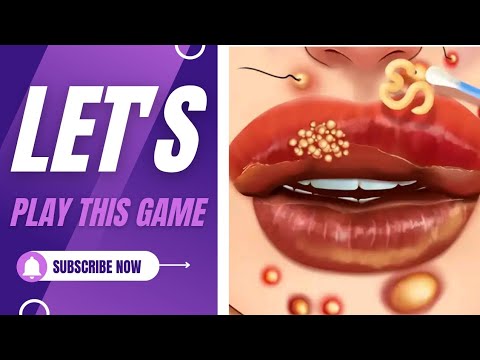 ASMR Pimple 2023 | Skin Care Animation |Acne Treatment | Satisfying Ear ...