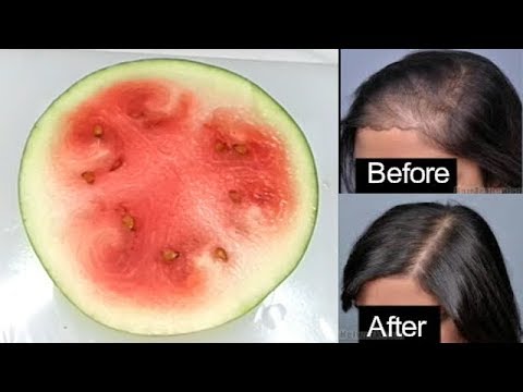 WATER MELON JUICE WILL GROW YOUR HAIR LIKE NEVER BEFORE SUPRISING HAIR ...