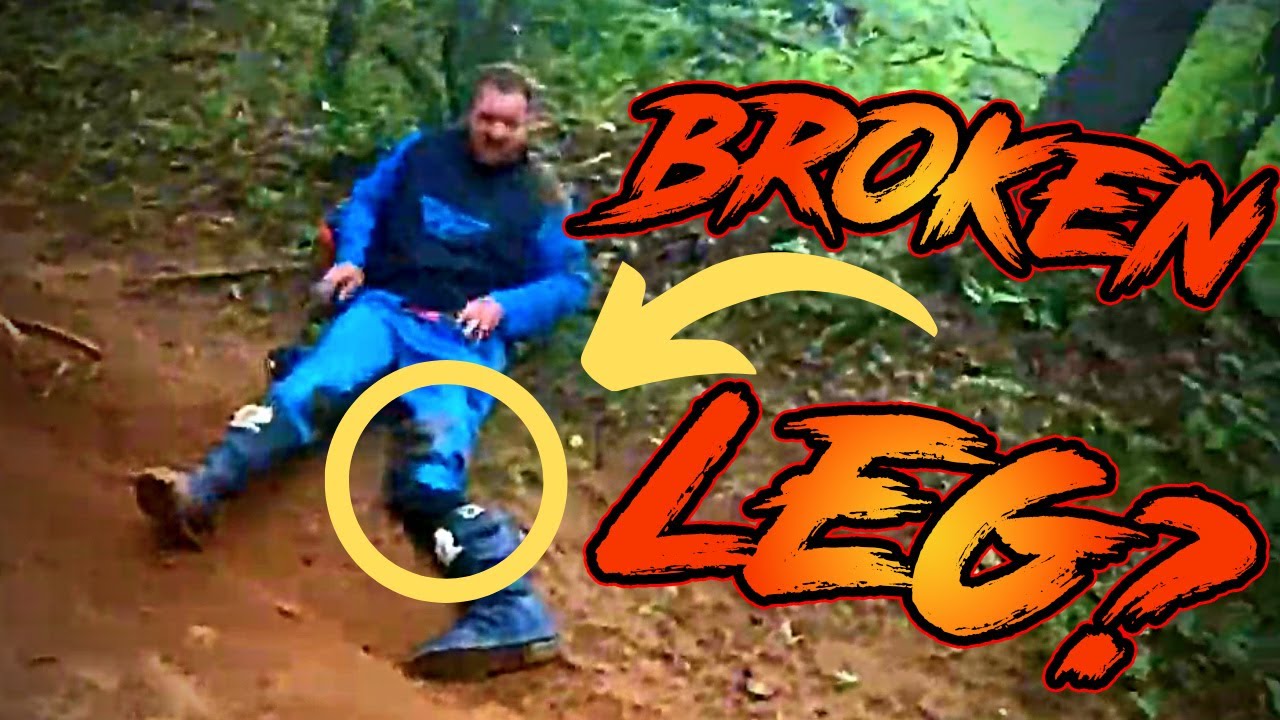 BIKER mistake leads to BROKEN LEG? | Motorcycle Crashes, EPIC Moto ...