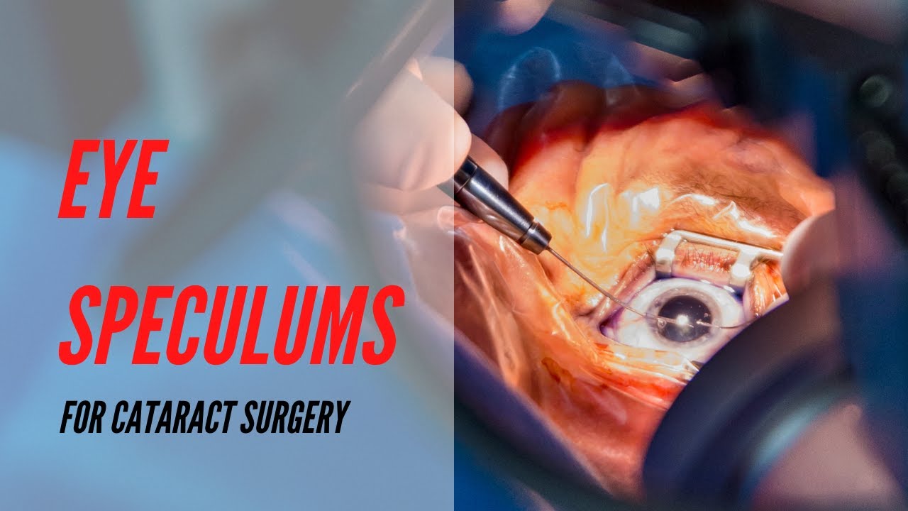 Eye Speculums for Cataract Surgery: - YouTube