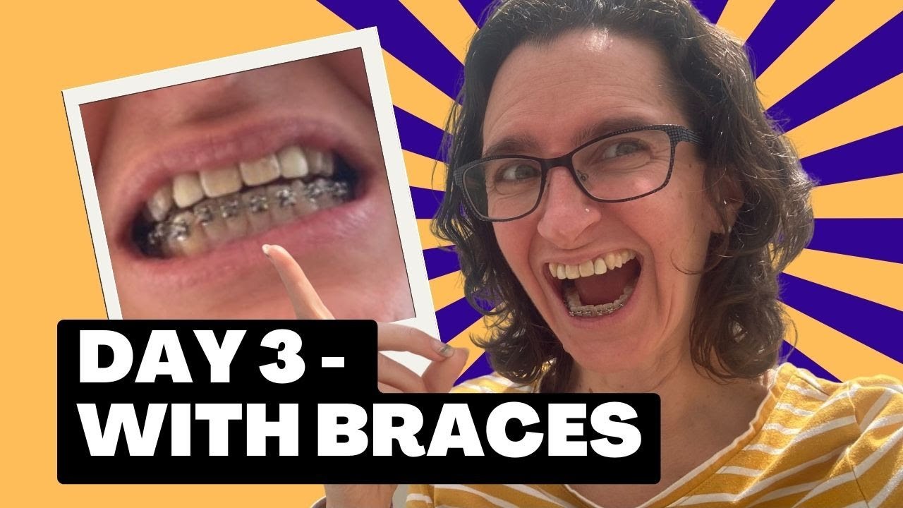 Day 3 with braces: A little bit at a time :) - YouTube