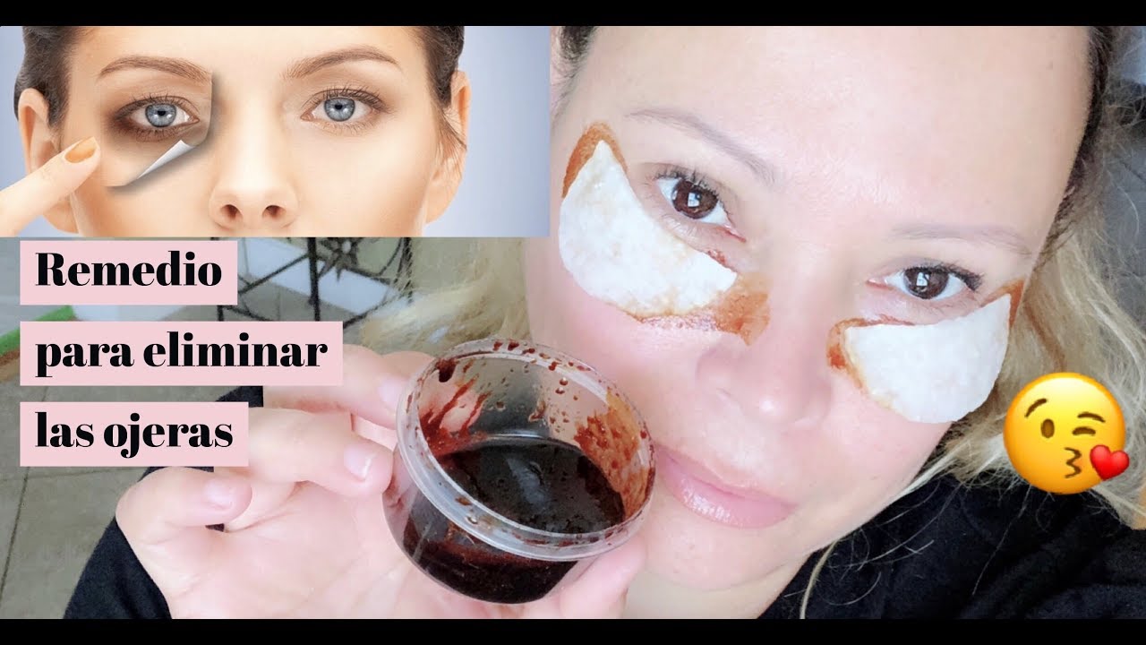 Remedio para eliminar ojeras - YouTube