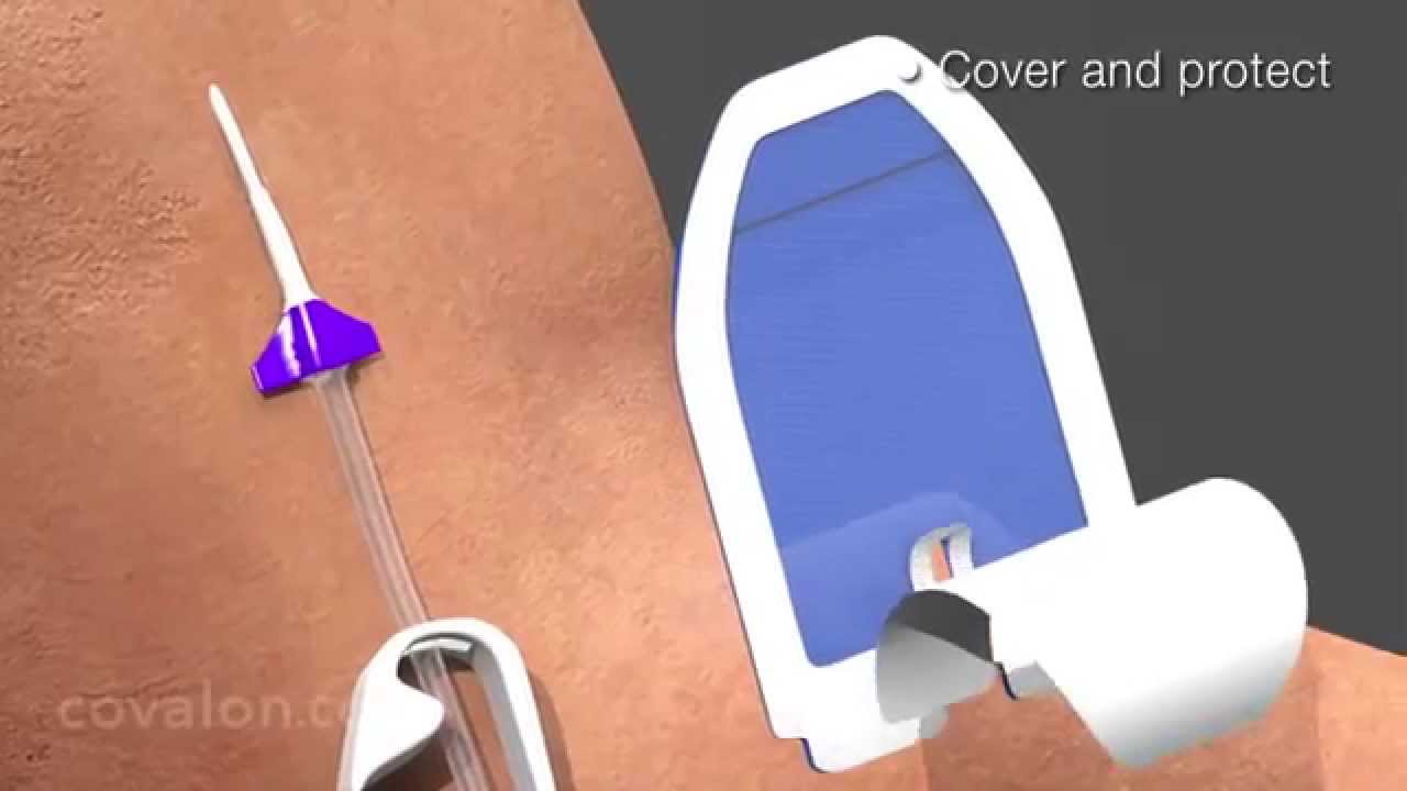 IV Clear Dual Antimicrobial Clear Silicone Adhesive Dressings - YouTube