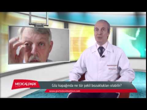 Göz Kapağı Şekil Bozuklukları Nelerdir?