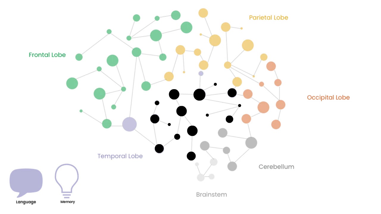 Progression of Primary Progressive Aphasia (PPA) - YouTube