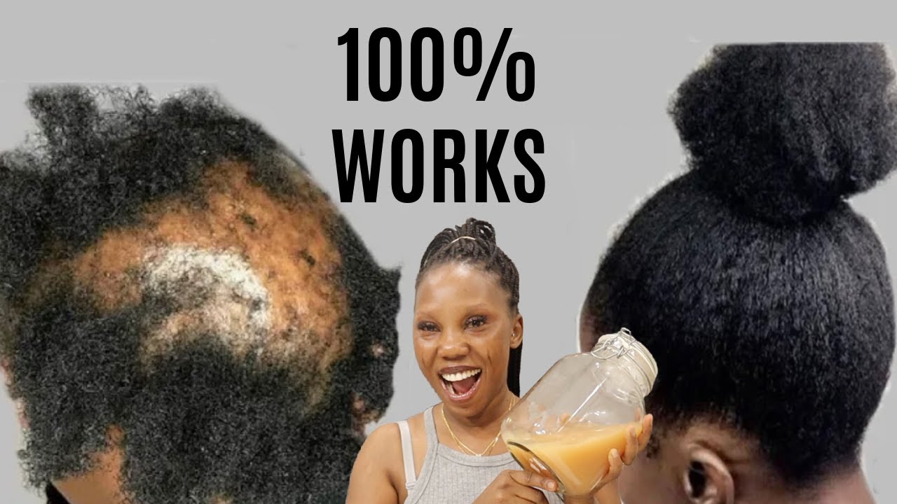 YOUR HAIR WILL NEVER STOP GROWING!!! ONLY 3 INGREDIENTS NO ONE SHARES ...