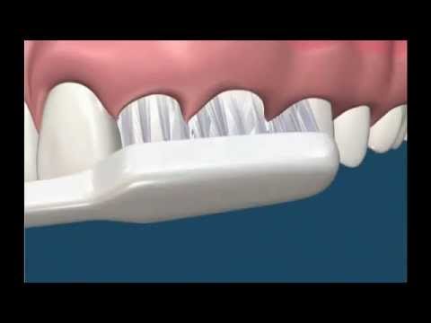 Tooth Brushing Technique - Dental hygiene in Sydney Castle Hill ...