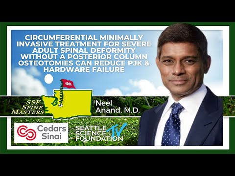 Circumferential MIS Treatment for Severe Adult Spinal Deformity - Neel ...