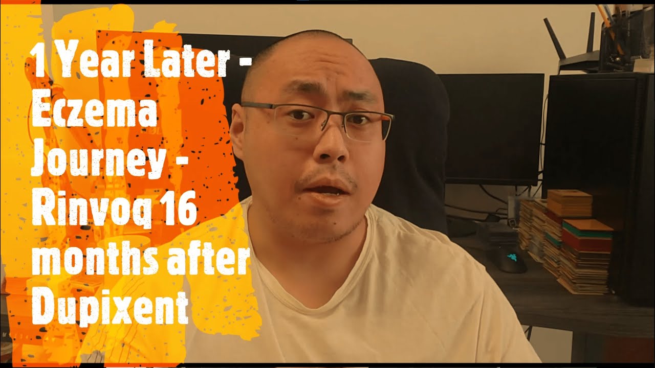 1 Year Later - Eczema Treatment Journey - Rinvoq 16 Months After ...