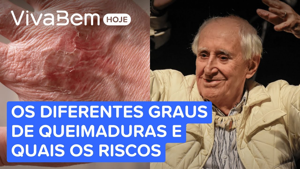 Quais os diferentes graus de queimaduras e os riscos - YouTube