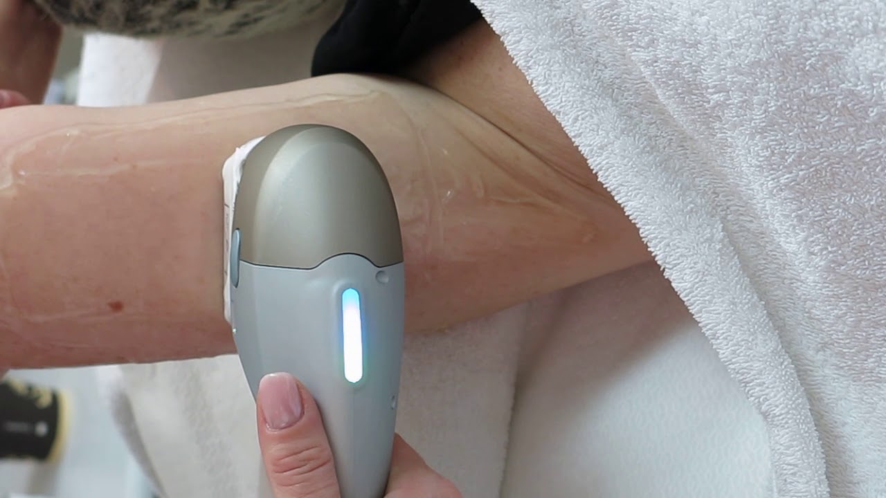 Hifu For the Arms by Lilach Kaplan Tel Aviv 2018 - YouTube