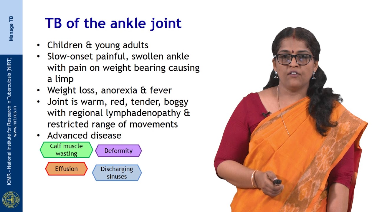 7 Clinical manifestations of TB Session 02 - YouTube