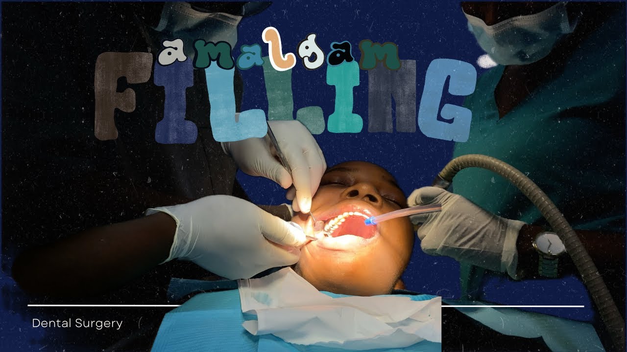 Amalgam Dental filling - YouTube