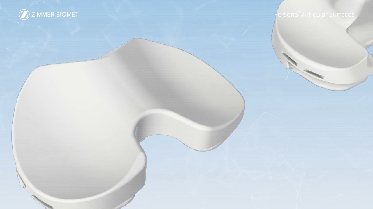 Persona The Original Personalized Knee - Persona Articular Surfaces ...