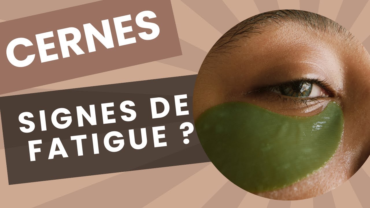Les cernes – Signes de fatigue : Causes, impacts et solutions efficaces ...