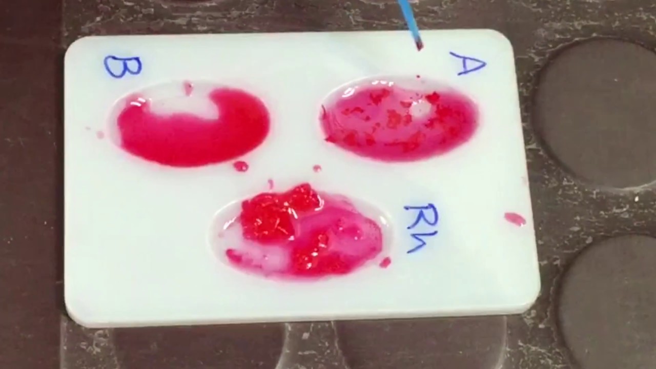 Human Blood Type Test - YouTube