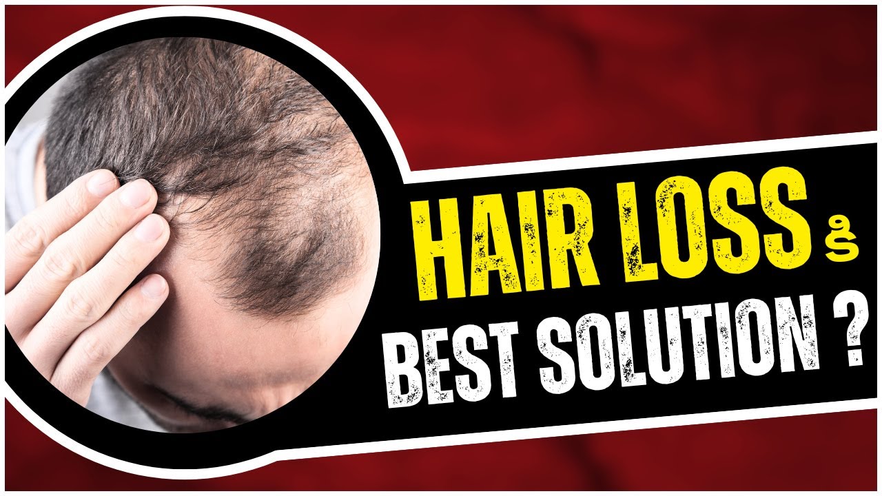 #AskDrJohnWatts | HAIR LOSS కి BEST SOLUTION ? | Hair Specialist ...