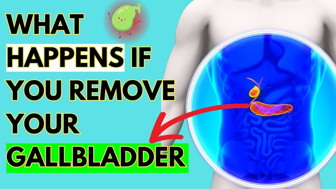 What Happens If You Remove Your Gallbladder? (Must Know!) - YouTube