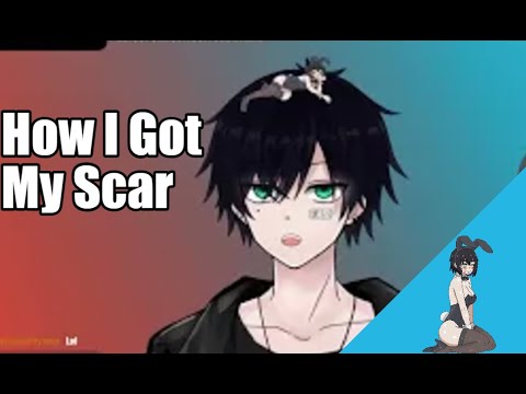 How A Girl Busted His Lip And Gave Him A Scar...... (Featuring Mario ...