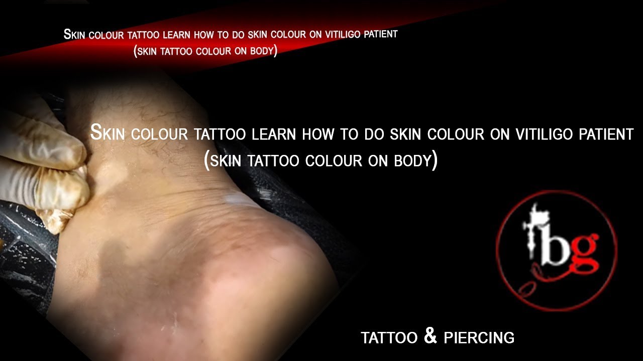 Skin colour tattoo learn how to do skin colour on vitiligo patient ...