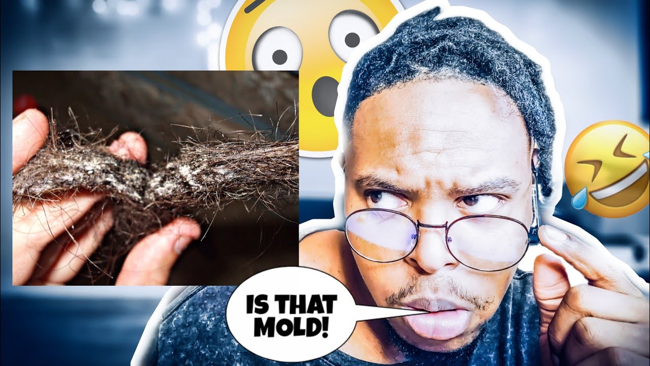 What causes mold in dreadlocks | Things to stay away from - YouTube