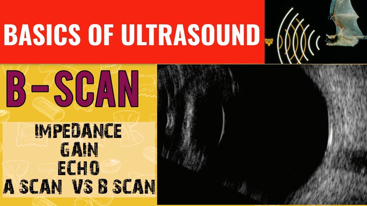B SCAN COURSE || BASICS OF ULTRASOUND || A scan vs B scan|| IMPEDANCE ...