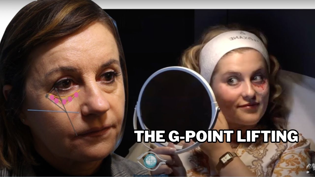 The G-Point Lifting for the Infra-Orbital Region - YouTube