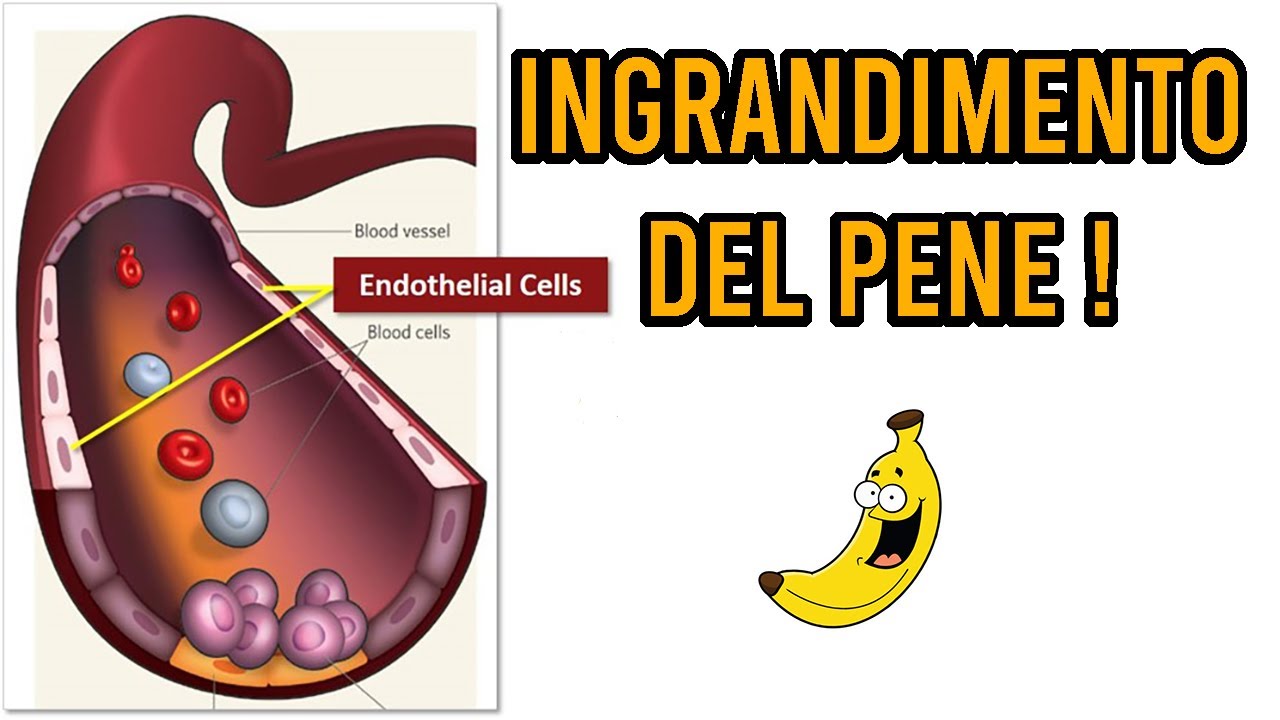 Tecnica BFR: Arterializzazione per un pene più grande ! Angion Method ...