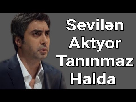 50 Yaşlı Polat Alemdar Tanınmaz Halda - FOTO