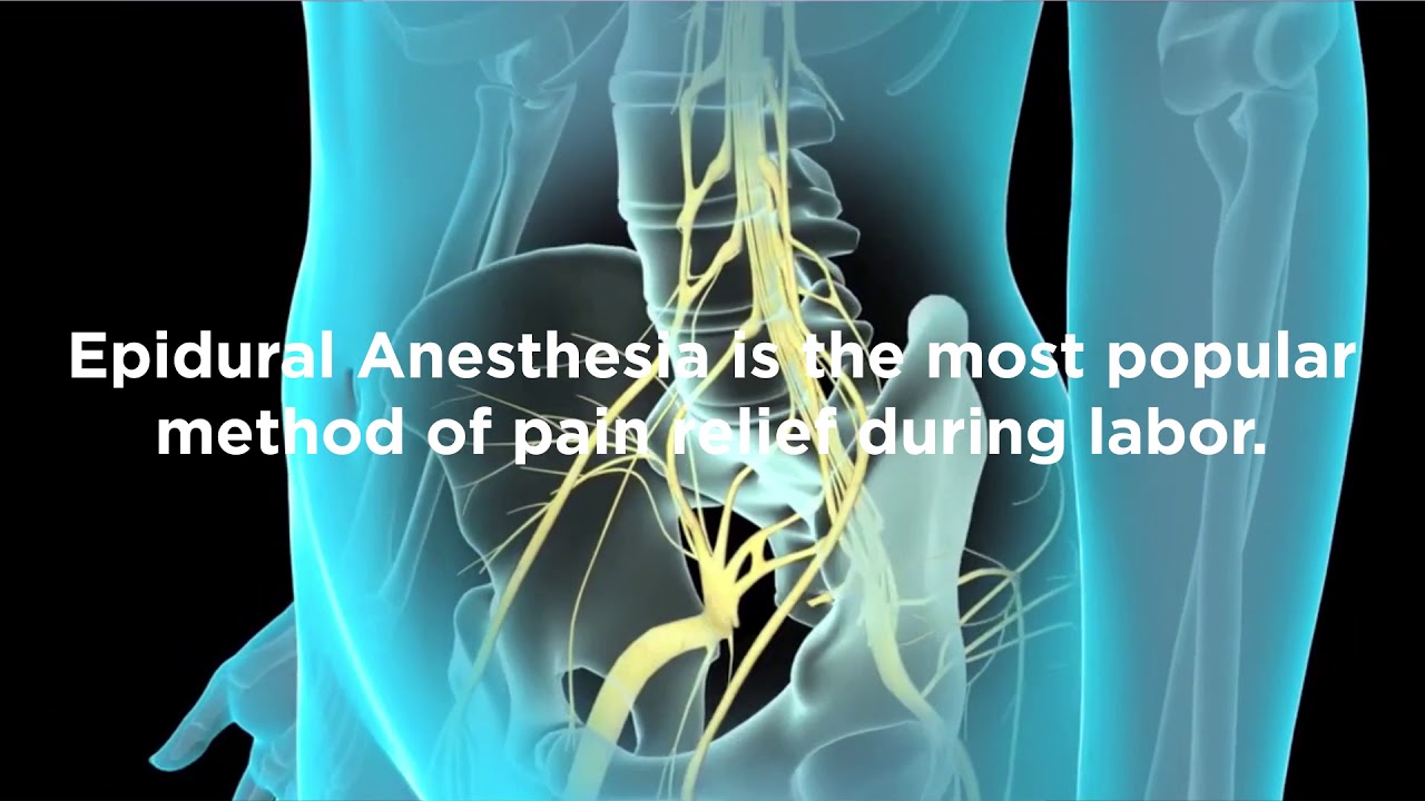 What is Painless Labour or Epidural Analgesia | Painless Delivery at ...