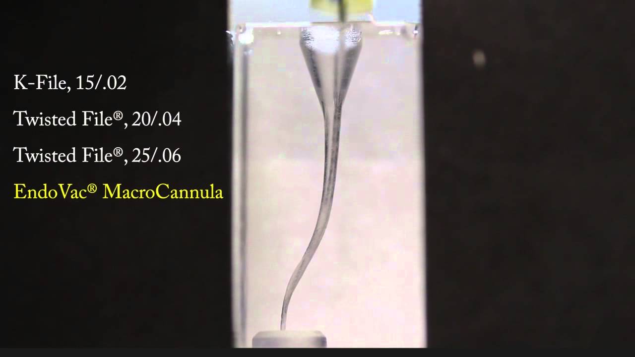 Twisted File Adaptive, EndoVac by Drs. Plazas & Cherkas, EndoArt.ca ...