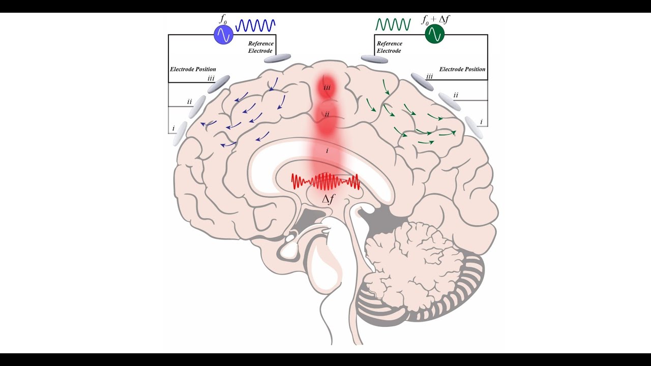 Preliminary Guidelines for Electrode Positioning in Temporal ...