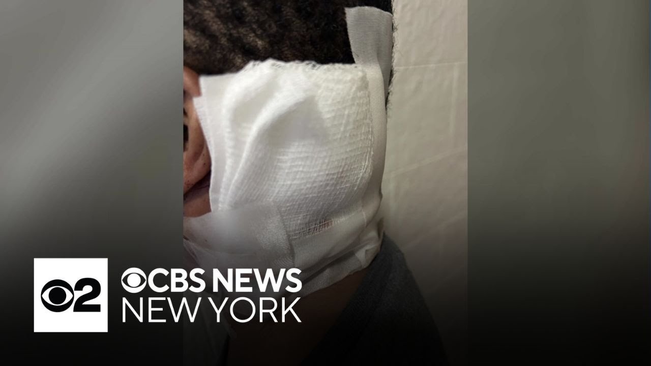 Person in custody for random slashings in Brooklyn, NYPD says - YouTube