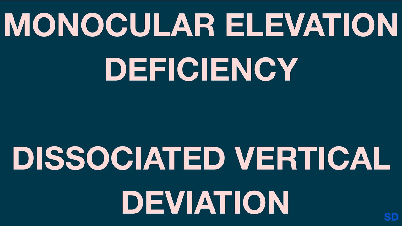 Strabismus and Pediatric: Session 14: Vertical Strabismus (Part 2 ...