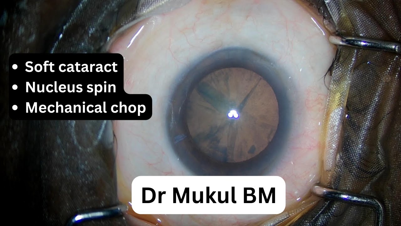 Stop and mechanical chop - YouTube