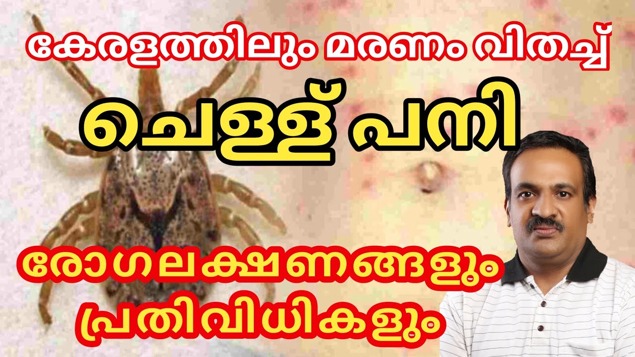 ചെള്ള് പനി കേരളത്തിലും | Scrub Typhus Symptoms and precuations - YouTube