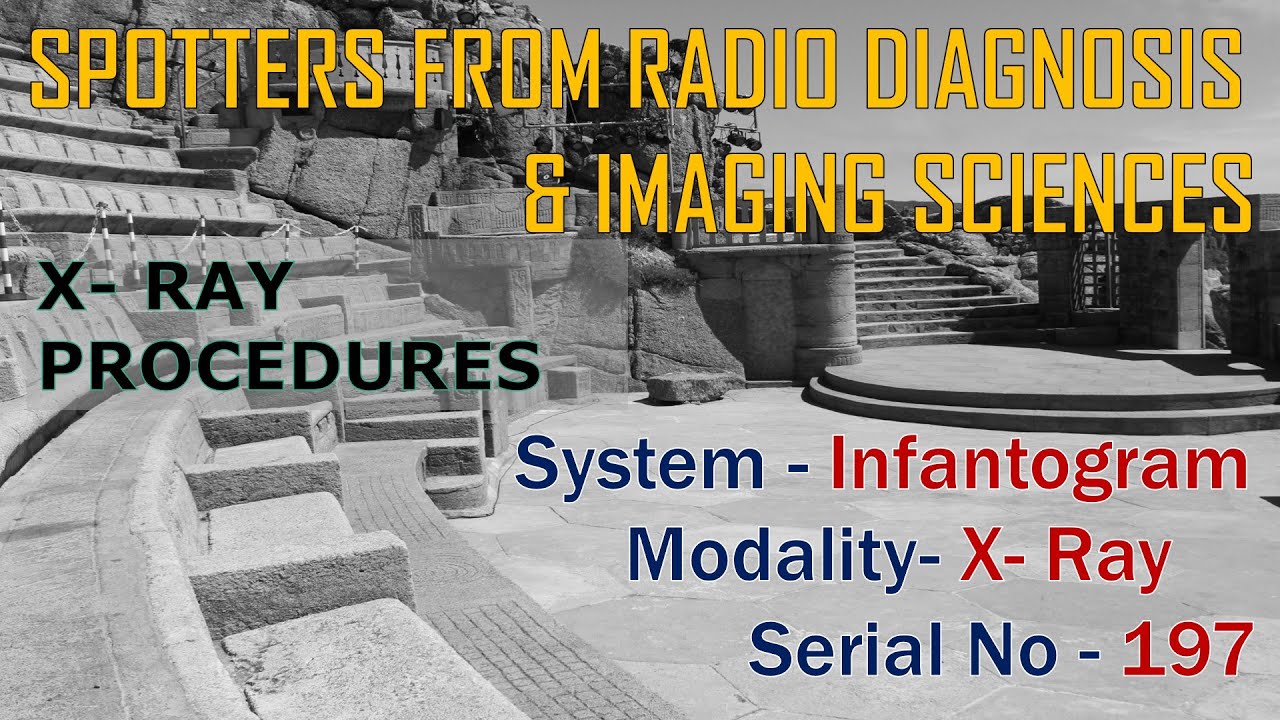 SPOTTERS FROM X-RAY INFANTOGRAM (SERIAL NO - 197) BY DR . ANIL JOSHI ...