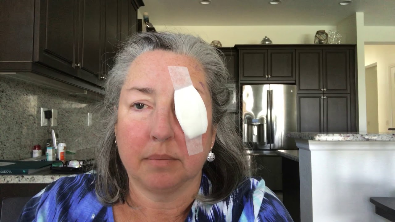 Post Op of my Vitrectomy - YouTube