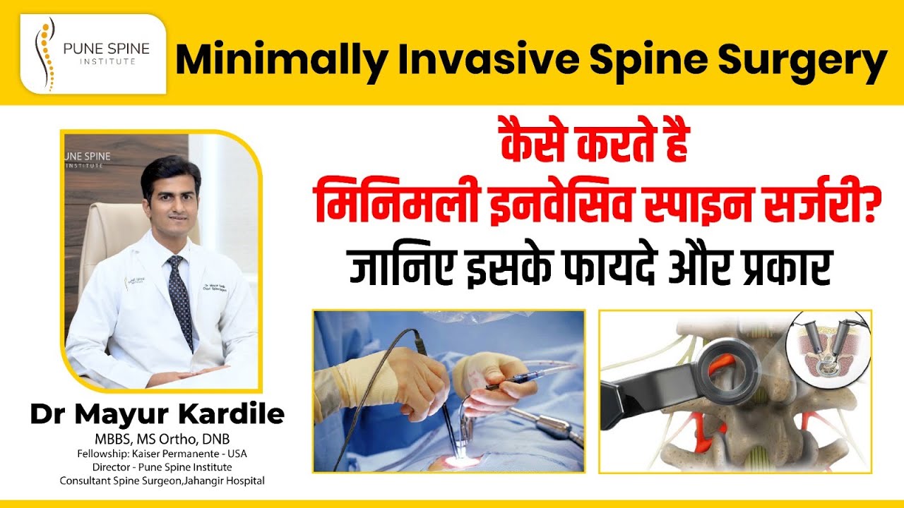What is Minimally Invasive Spine Surgery | MISS क्या है और इसके प्रकार ...