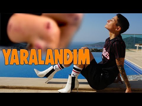 TOPUKLU AYAKKABI İLE DEPAR ATTIM ( YARALANDIM )