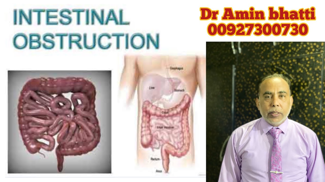 intestine obstruction, blocking intestine,Bowel obstruction ...