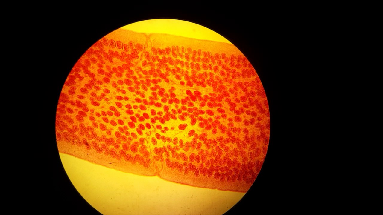 Dipylidium caninum gravid proglottid - YouTube