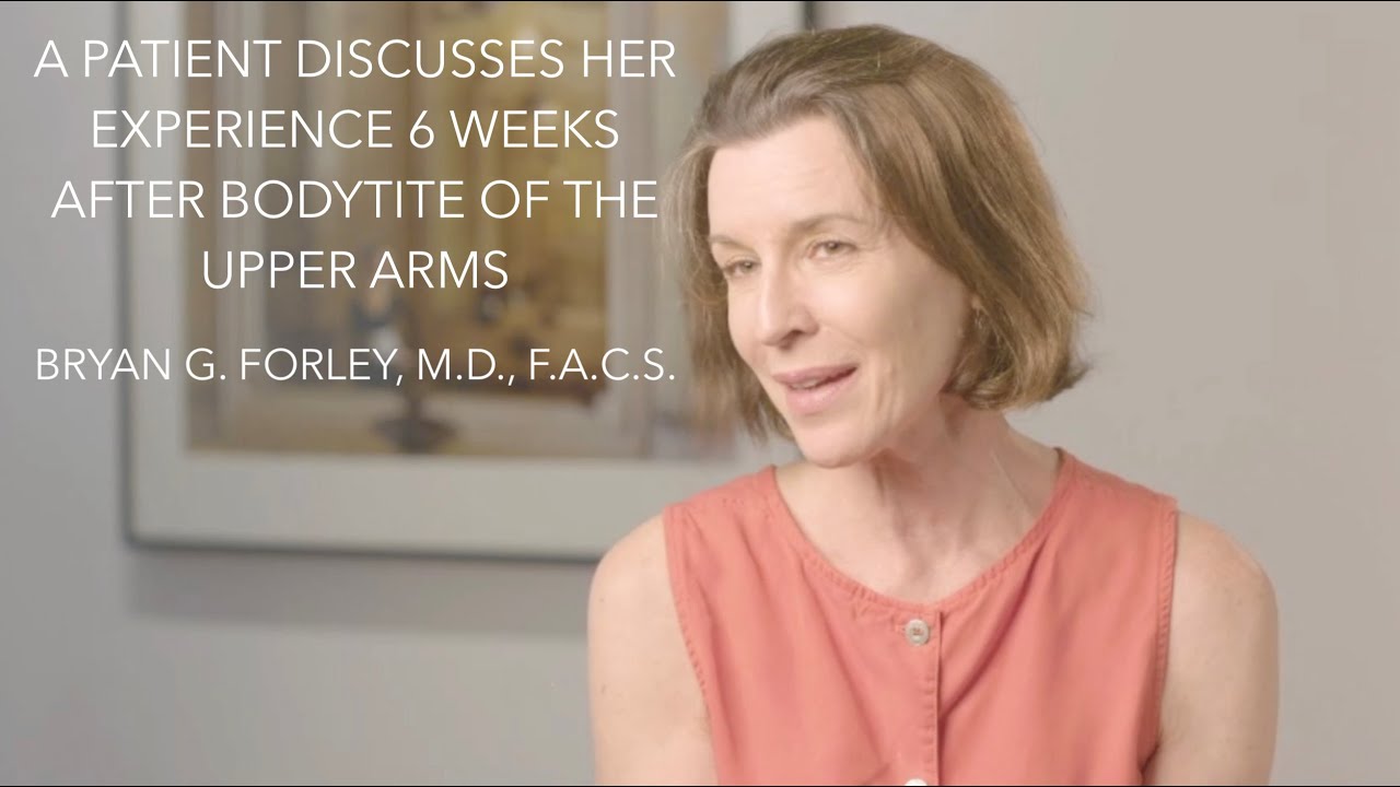 NYC PATIENT DISCUSSES HER UPPER ARM BODYTITE EXPERIENCE| Dr. Forley ...