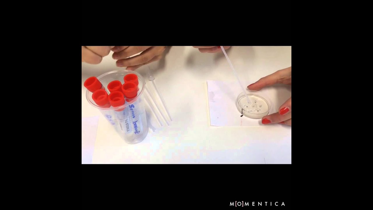 Methode De Double Diffusion En Gel D Ouchterlony YouTube methode-de-double-diffusion-en-gel-d-ouchterlony-youtube