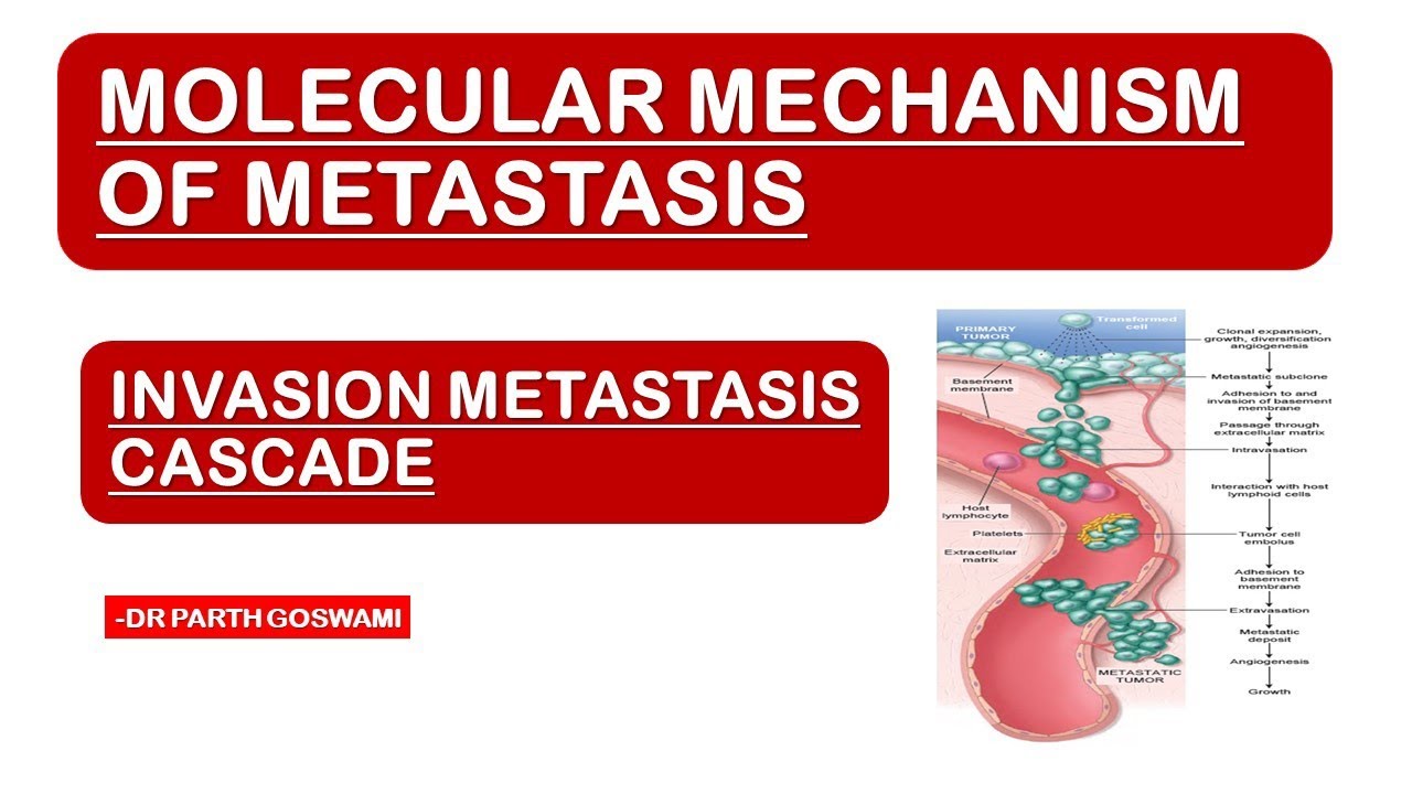 Molecular Basis of Metastasis | Invasion - Metastasis Cascade - YouTube